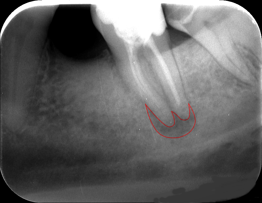 A fogászati röntgen és CT-felvételek | Uniklinik.hu - Együtt a specialisták