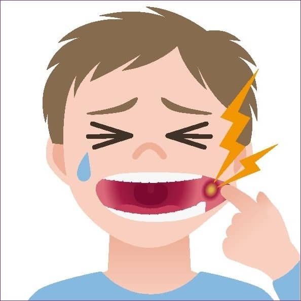 Az afta tünetei és kezelése - Uniklinik Fogászati és Implantációs ...