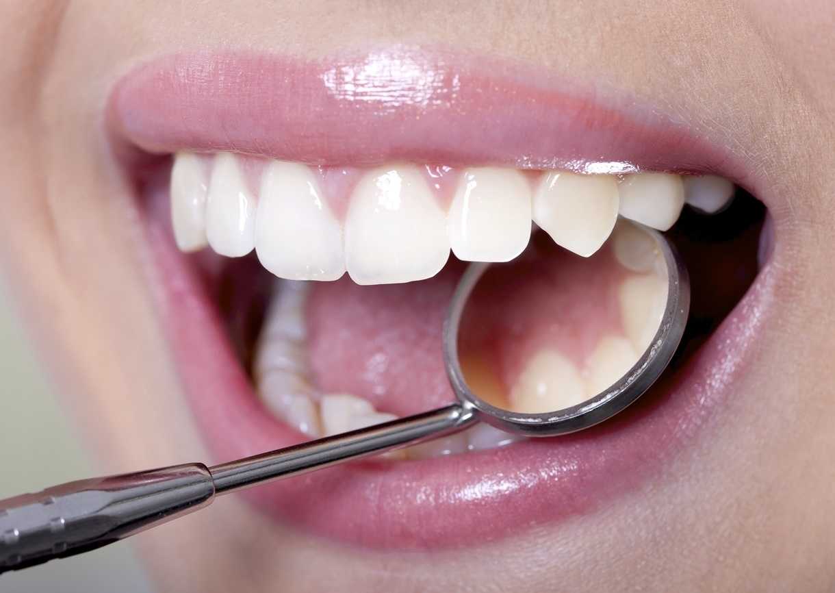 Az ínygyulladás a világ 6. leggyakoribb betegsége